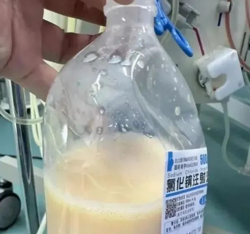 【小编看世界】危险！不规范饮食导致女子抽出牛奶血 - 新鲜事 - 中职易班 学生互动社区